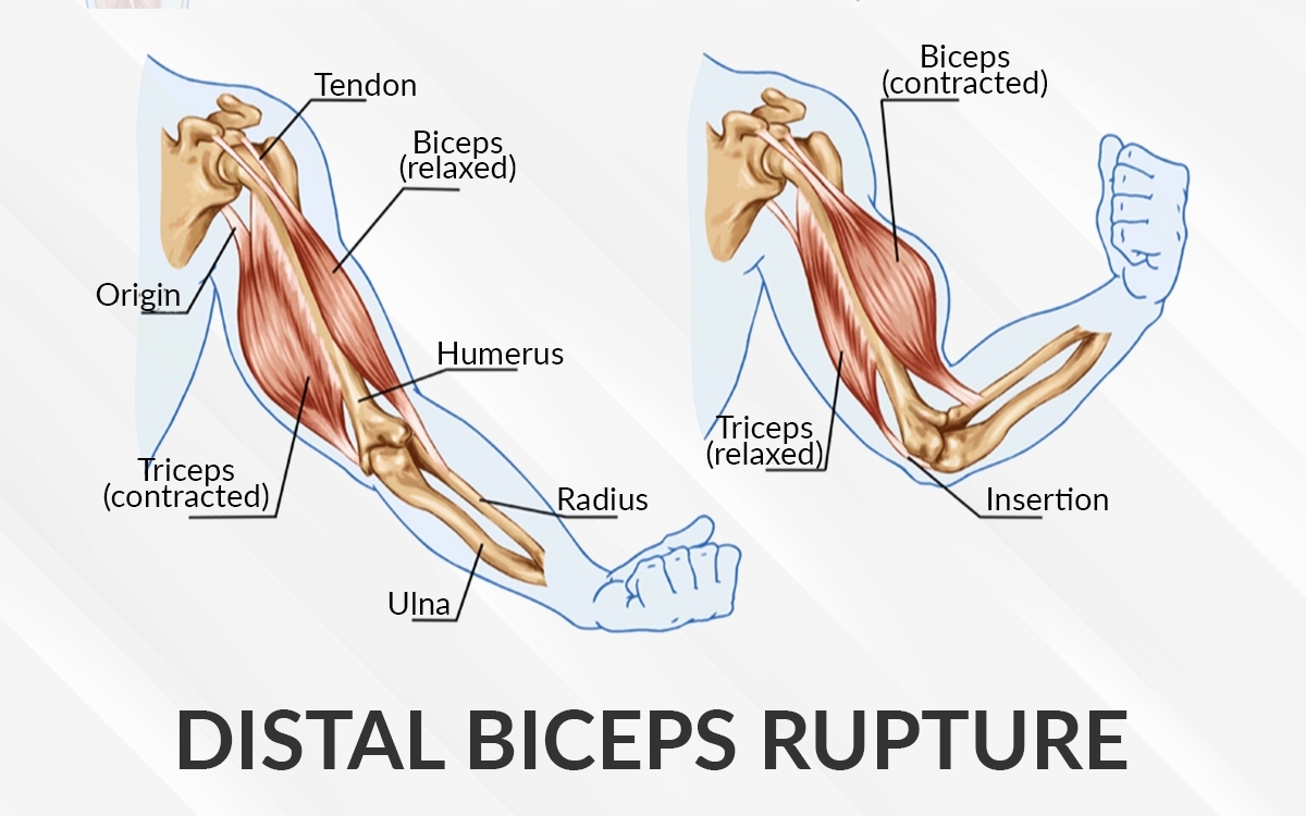 Elbow Pain Causes Treatment And When To See A Healthcare 59 OFF
