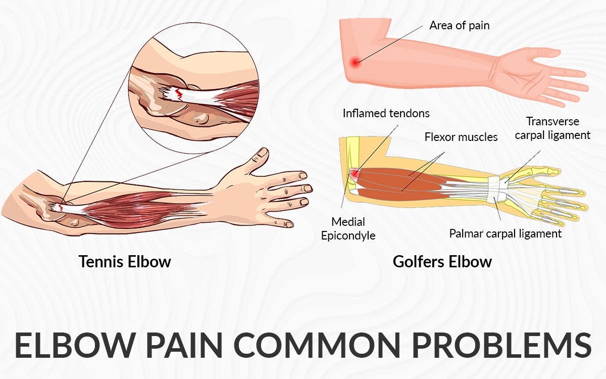 Elbow Pain Causes Treatment And When To See A Healthcare 48 OFF